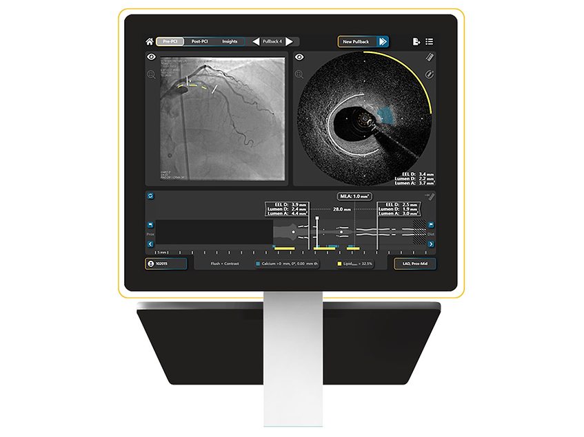 Spectrawave’s Hypervue sees $50M in support | BioWorld