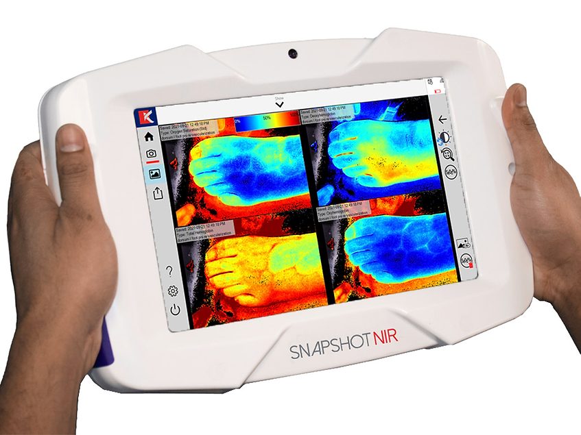 Kent Imaging looking to raise $25M for wound care devices | BioWorld