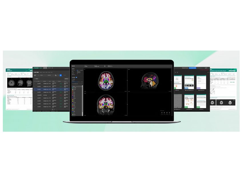 Neurophet wins FDA nod for brain AI software, targets US expansion ...