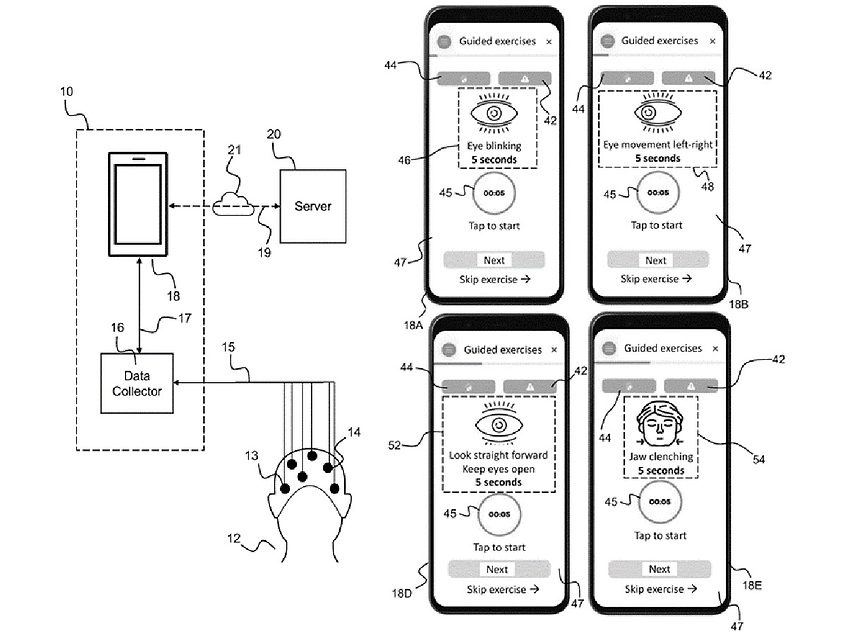 Braincapture system enables remote diagnosis of epilepsy | BioWorld