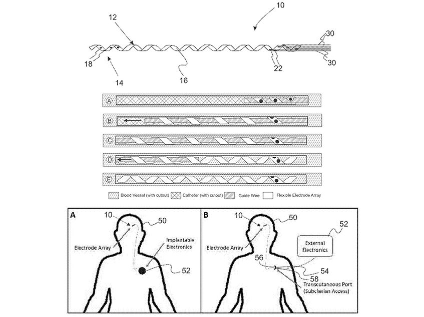 USC team develops minimally invasive neural recording, stimulation ...