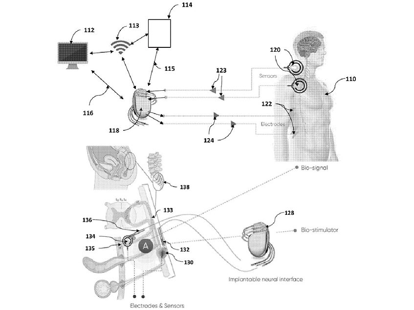 Amber Therapeutics exploring alternative uses for bioelectric device ...