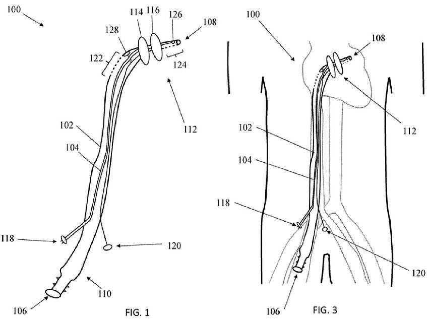 UCLA researchers file patent for cardiopulmonary support cannula | BioWorld