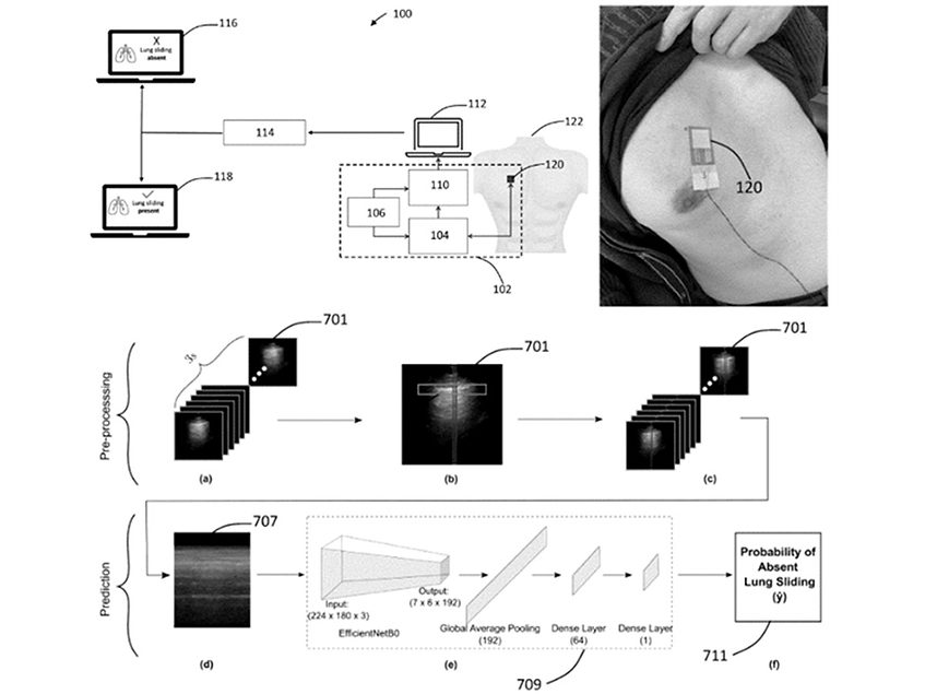 Deep Breathe’s wearable AI-powered POC lung ultrasound imaging system ...
