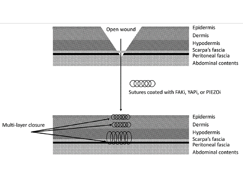 Researchers develop coating for surgical sutures to reduce scarring ...