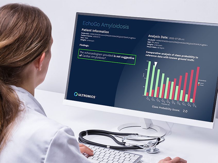 Ultromics partners with Pfizer on cardiac amyloidosis detection | BioWorld