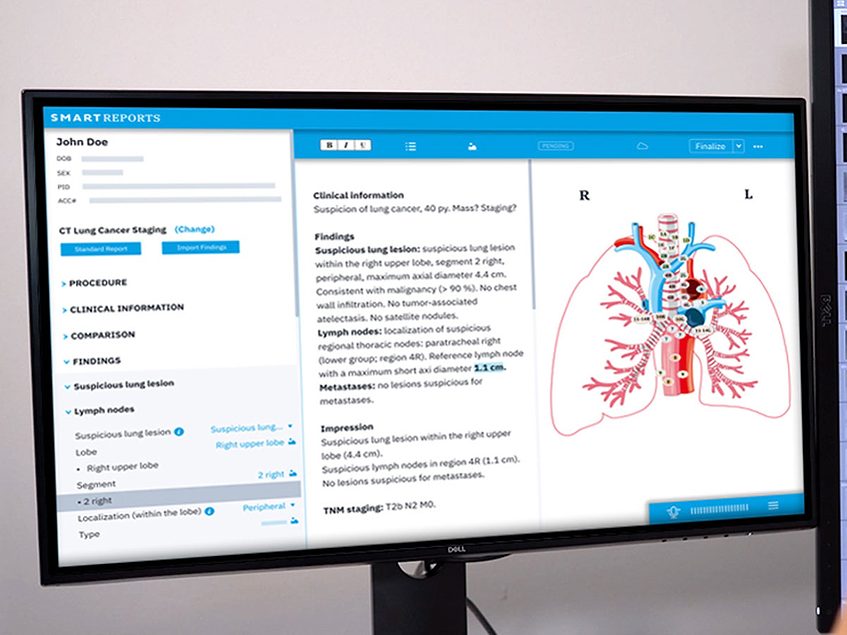 Smart Reporting raises €23M for medical software | BioWorld
