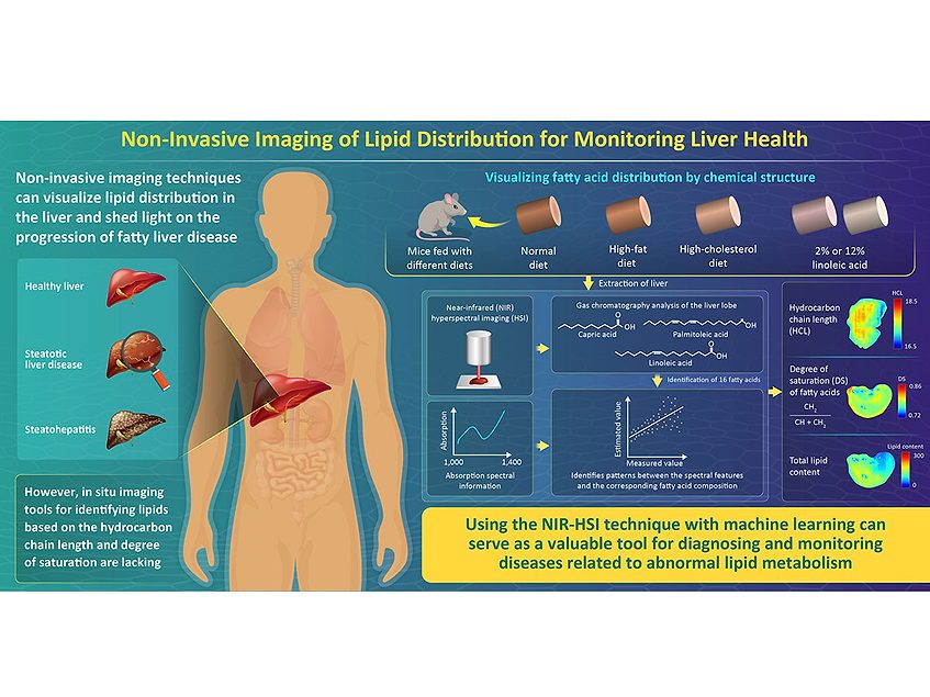 New non-invasive imaging tech visualizes liver fat | BioWorld