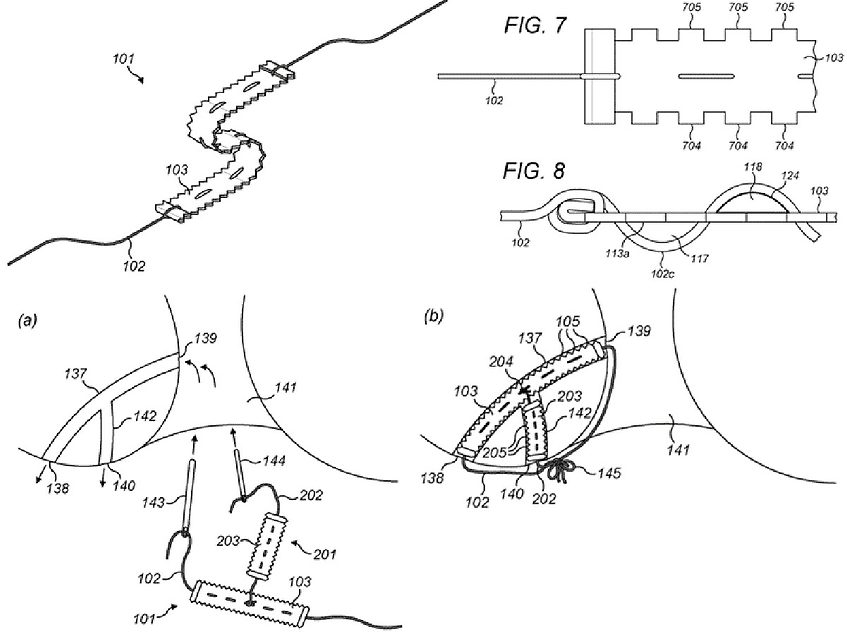 Researchers improve device for treating fistulas | BioWorld