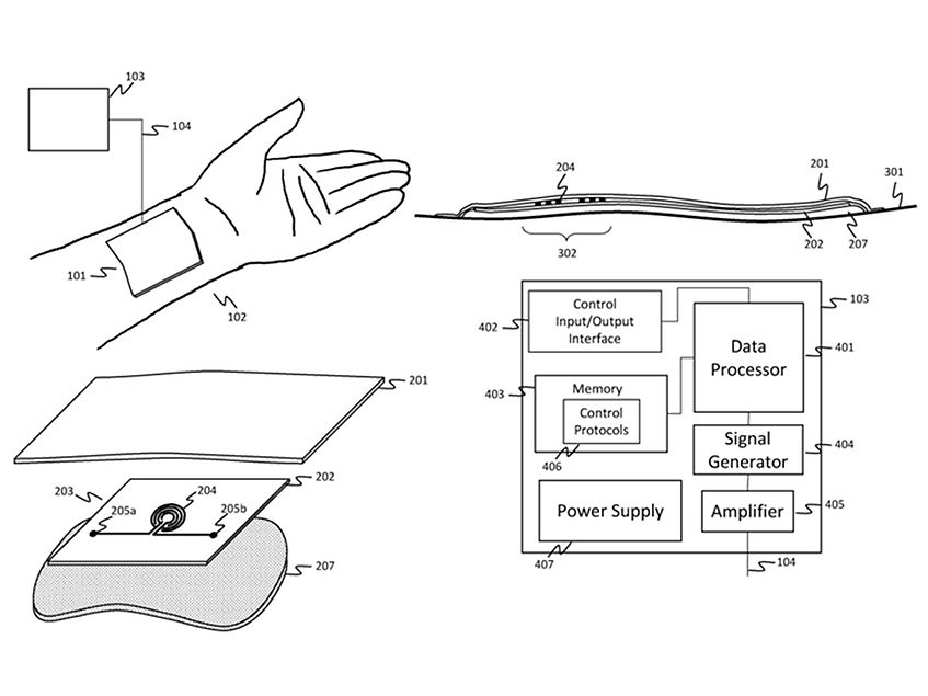 Wearable acoustic patch developed for transdermal drug delivery | BioWorld