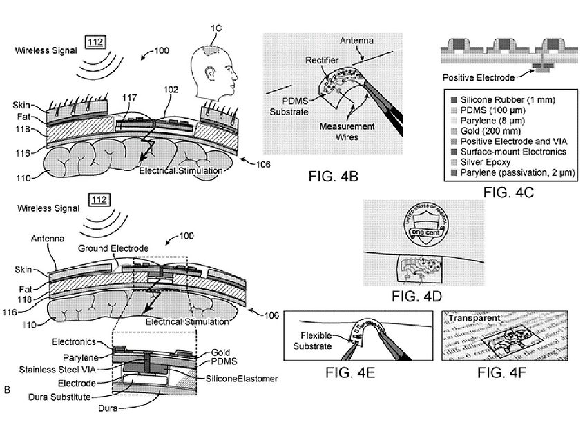 Researchers develop brain implant for neural recording, stimulation ...