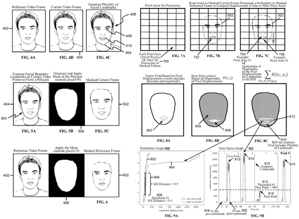 Seeme helps measure, detect consciousness after TBI | BioWorld