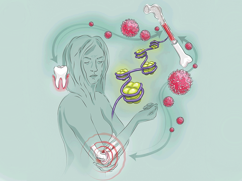 Innate immune memory underlies inflammatory comorbidities: study | BioWorld