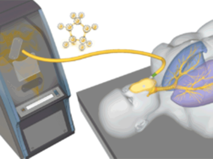 Australia’s Cyclopharm raises AU$30M ahead of U.S. launch of Technegas ...