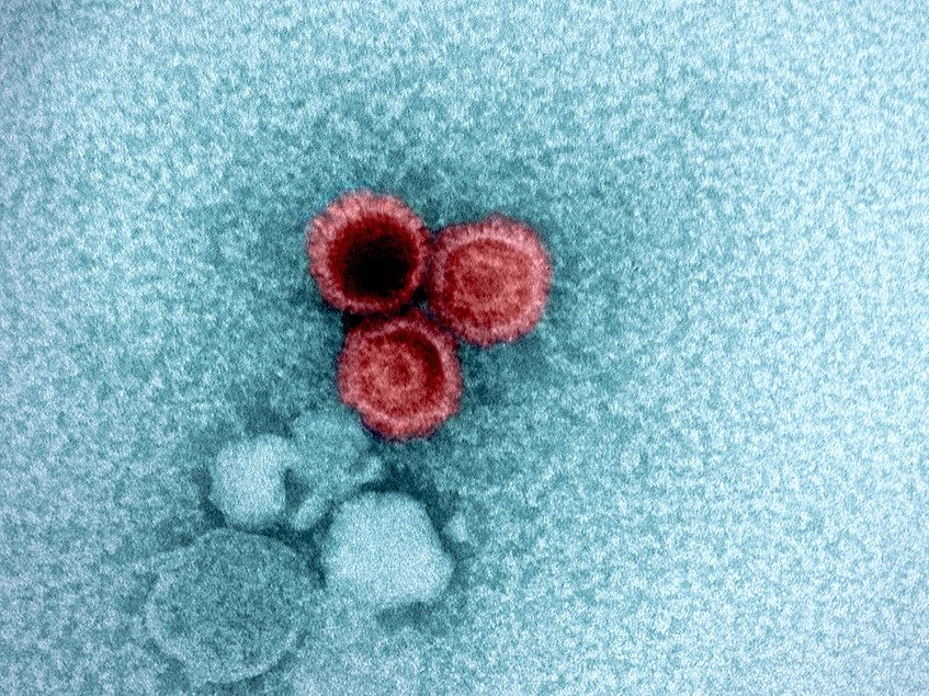 Innovative Molecules adds EBV antiviral program to pipeline | BioWorld