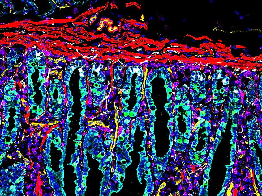 Human organ atlas maps healthy and diseased tissues at the cellular ...