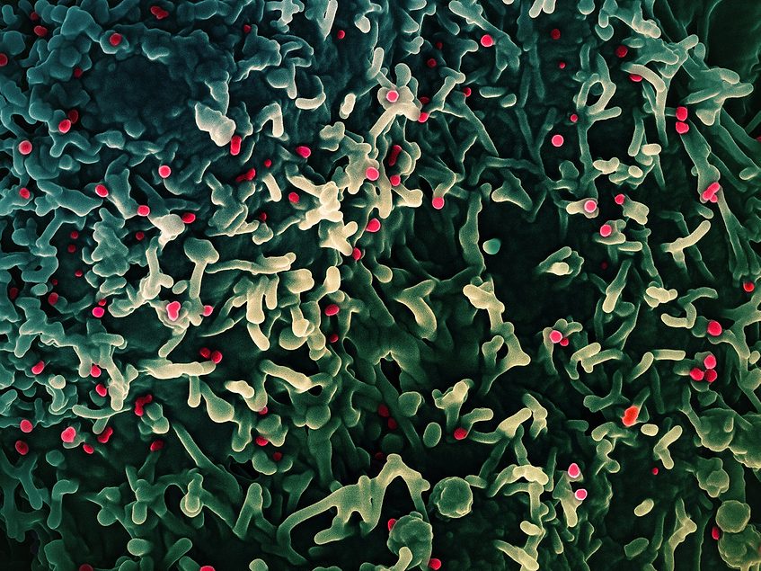 Multivalent mRNA vaccine prevents mpox disease | BioWorld