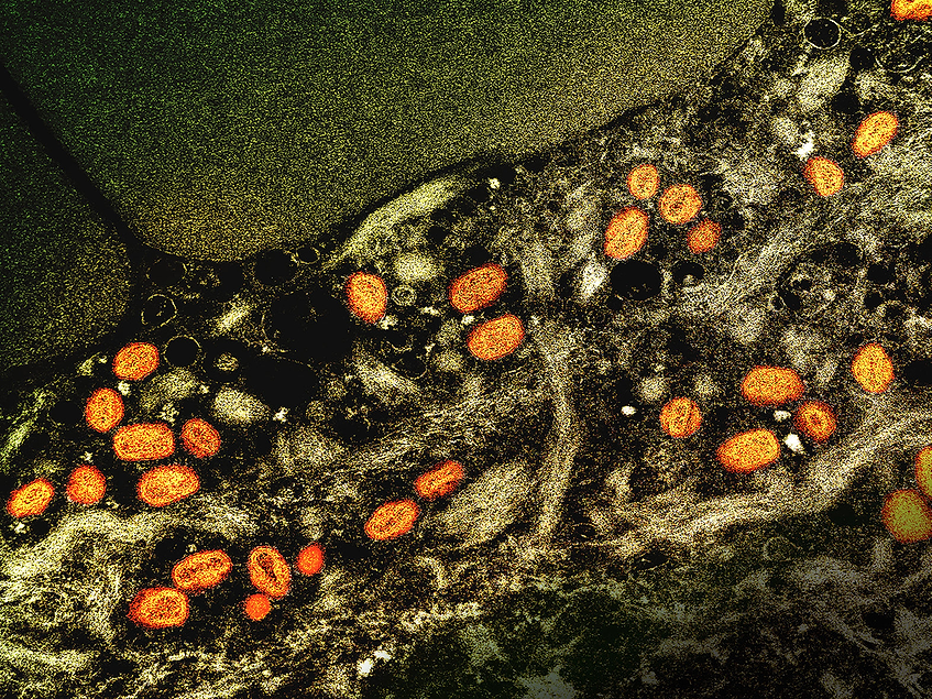 Mpox virus IIb.1 is less virulent than other mpox clades in a small ...