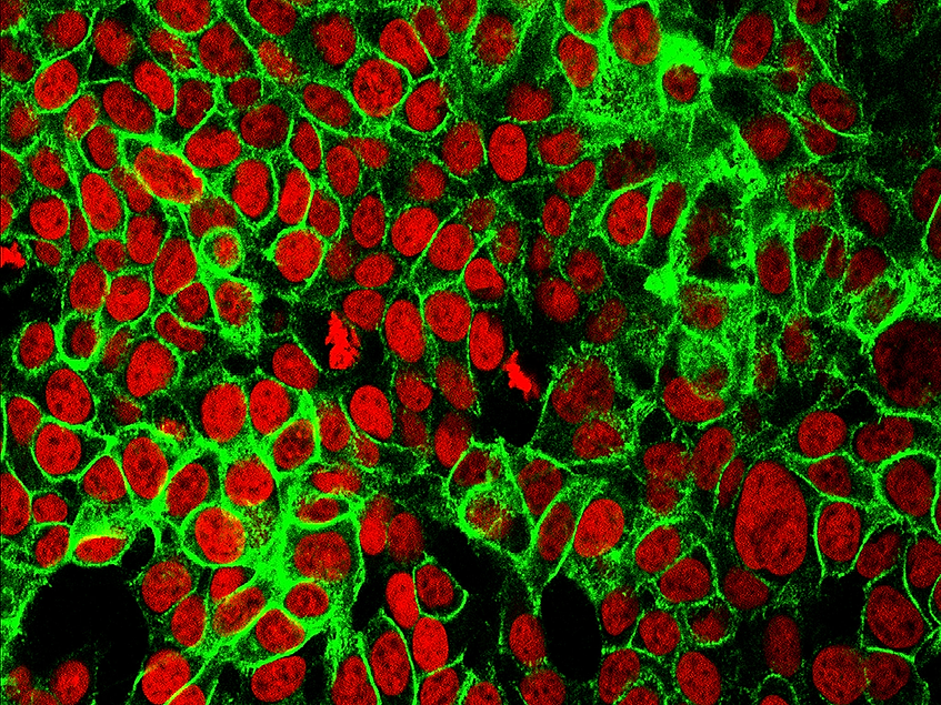 DHX9 inhibitor ATX-968 induces tumor regression in mice with colorectal ...