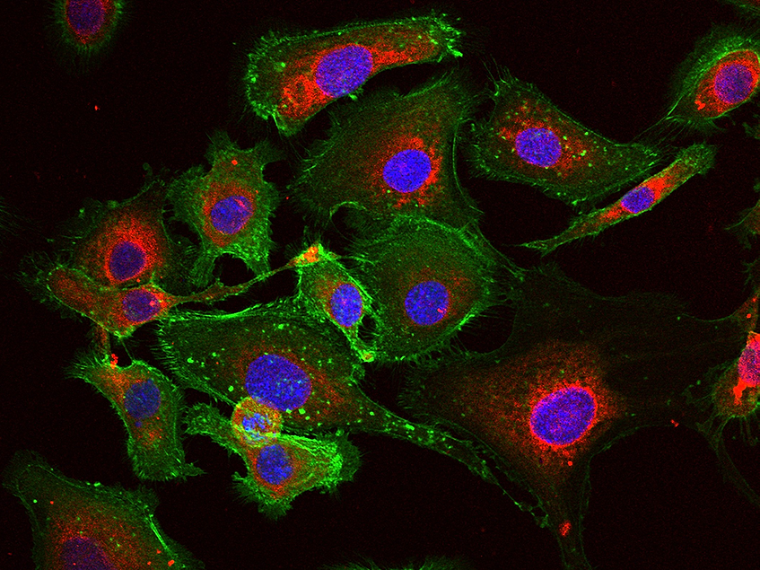 Sunshine Biopharma collaborates to advance LNP formulation of its ...