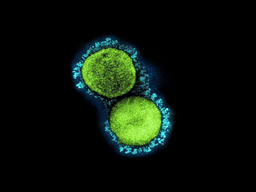 Exevir Bio’s XVR-012 demonstrates neutralization potency against ...