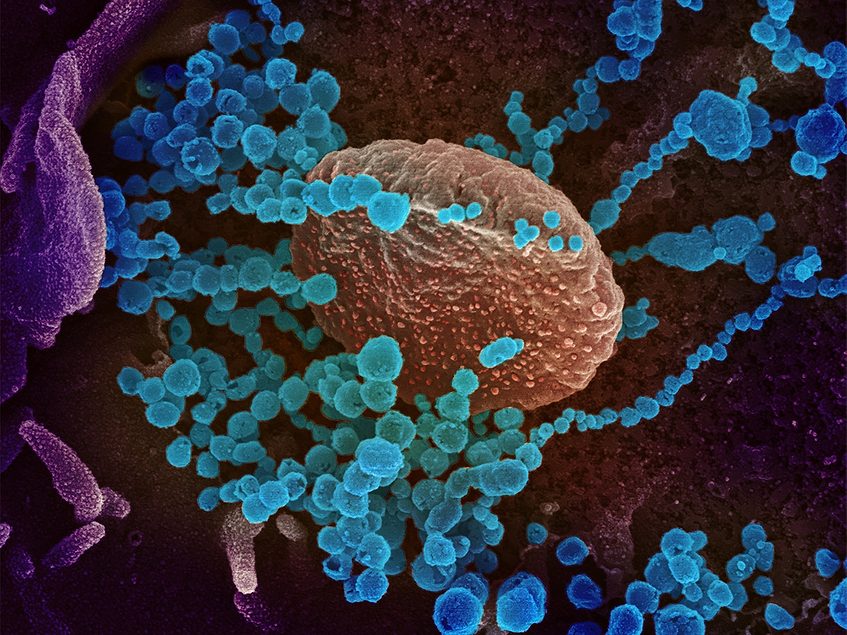 US NIH-funded study discloses no clear biomarkers for long COVID | BioWorld