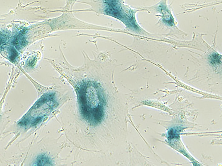 Financing at Senisca to advance senotherapeutics to treat age-related ...