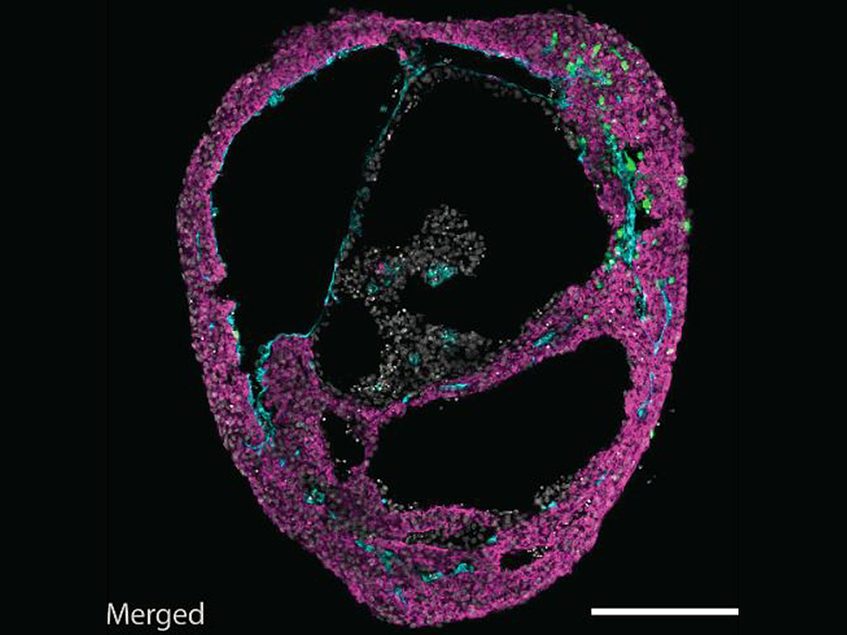 First interconnected organoid heart model starts beating | BioWorld