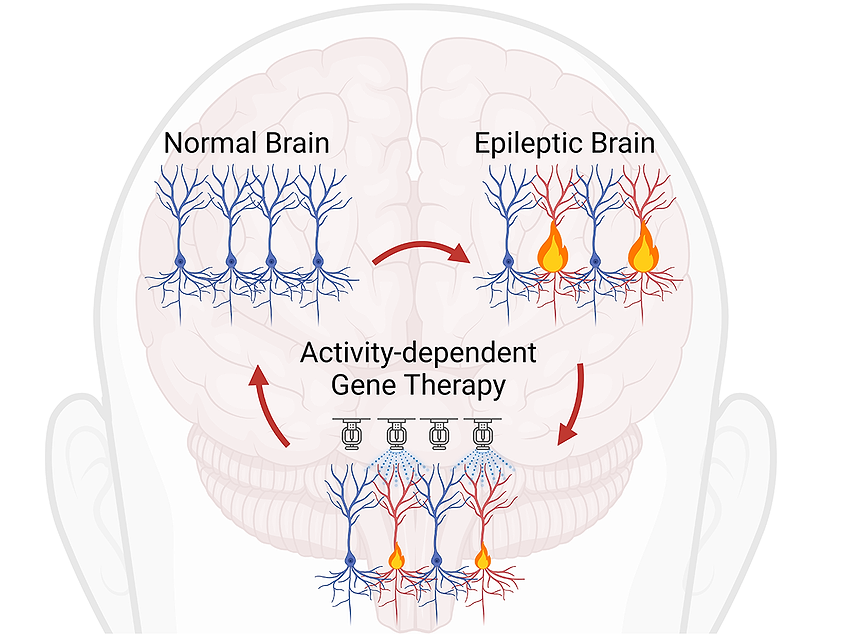 ‘On-demand’ epilepsy gene therapy selectively calms hyperactive cells ...