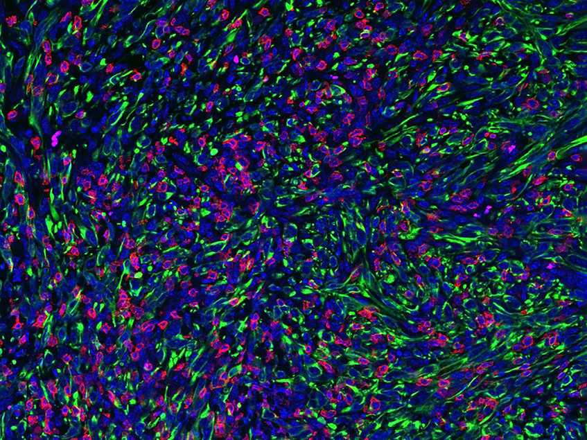 Opna Bio recasts mental retardation protein as cancer immunotherapy ...