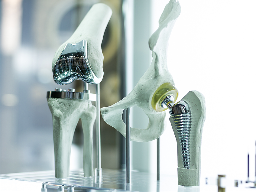 CMS adds three years to joint replacement demo, but device makers at ...