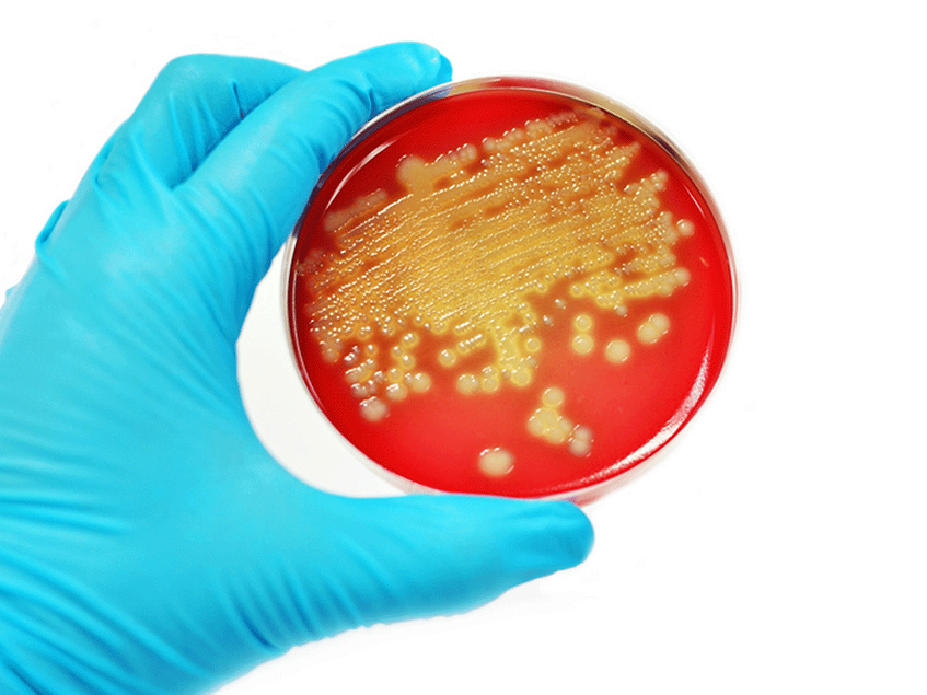 CARB-X supports antibiotic development at Harvard | BioWorld