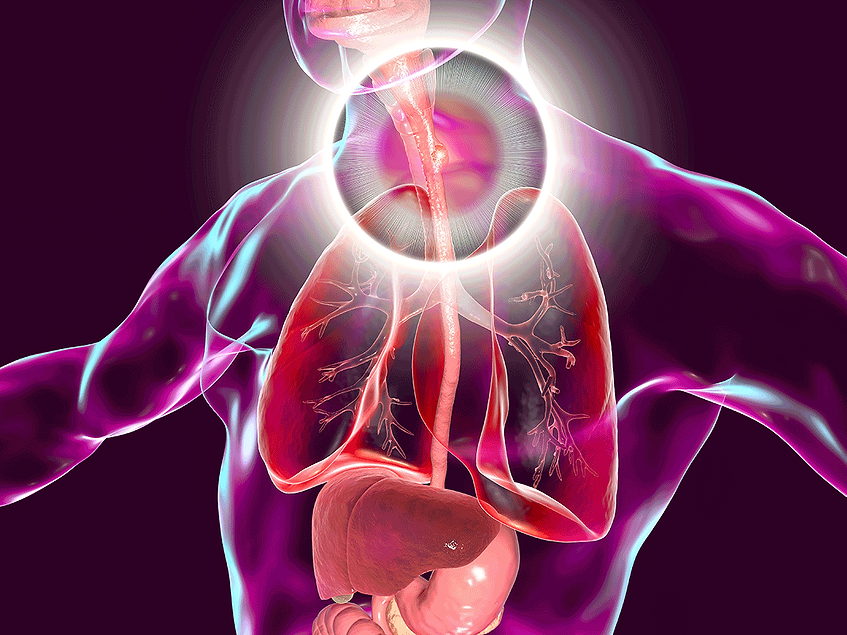 Cyted gets FDA approval for capsule sponge device | BioWorld