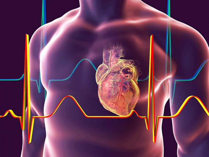 Milestone plots 2023 FDA filing after etripamil hits marks in heart ...
