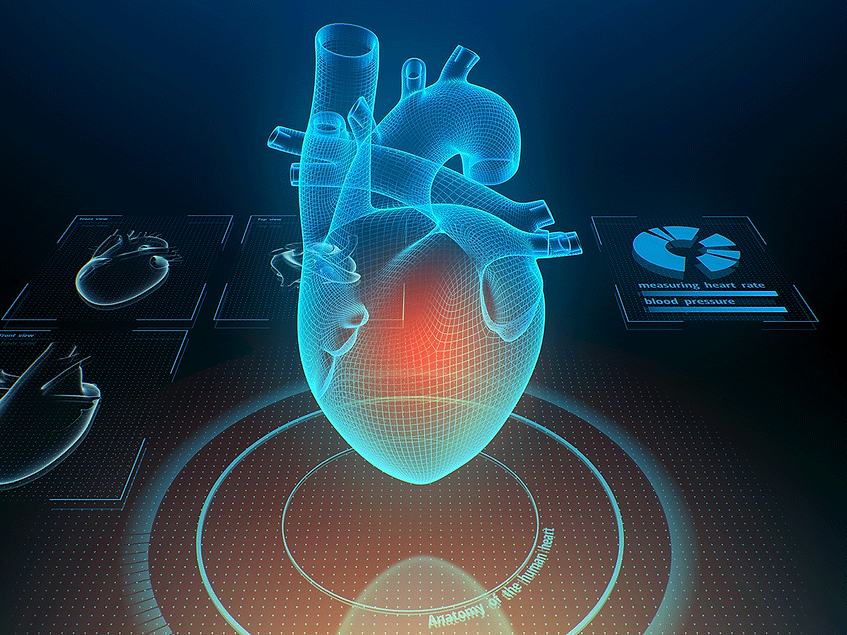 Feops Heartguide granted FDA de novo authorization for LAAo planning ...