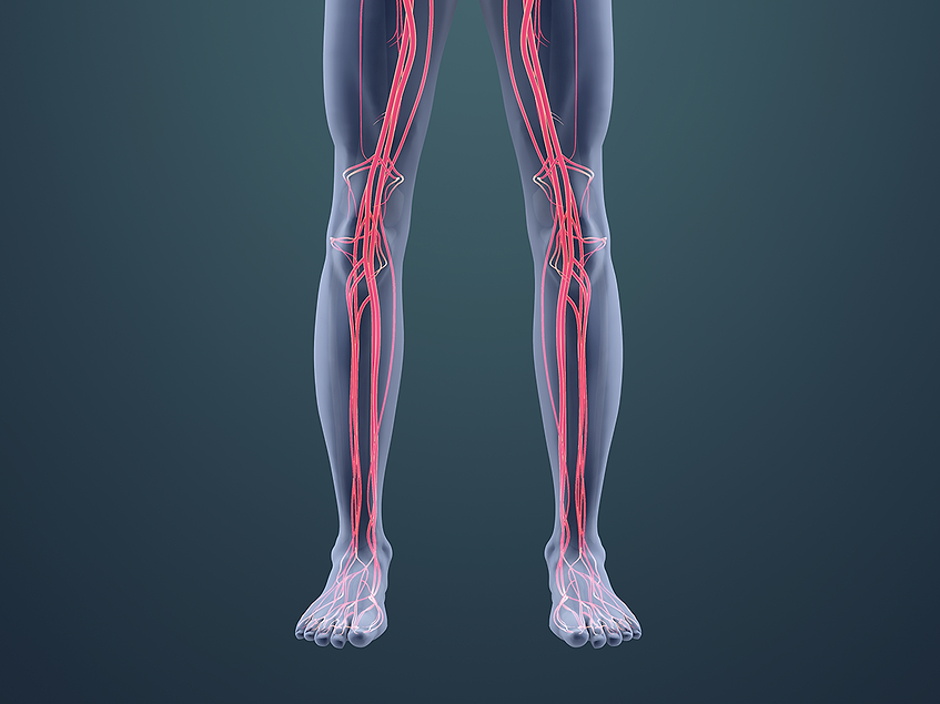 Results in for fully percutaneous, transmural arterial bypass therapy ...
