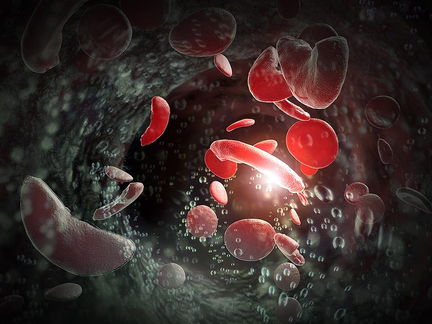 No red flags flying ahead of adcom on Vertex’s SCD therapy | BioWorld