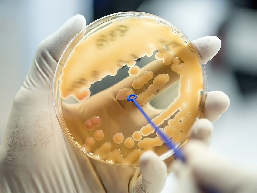 First-in-class non-β-lactam targeting AMR gram-negative pathogens ...