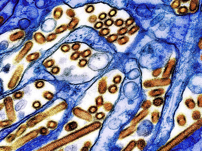 TC Biopharm looks to begin proof-of-concept preclinical studies for TCB ...