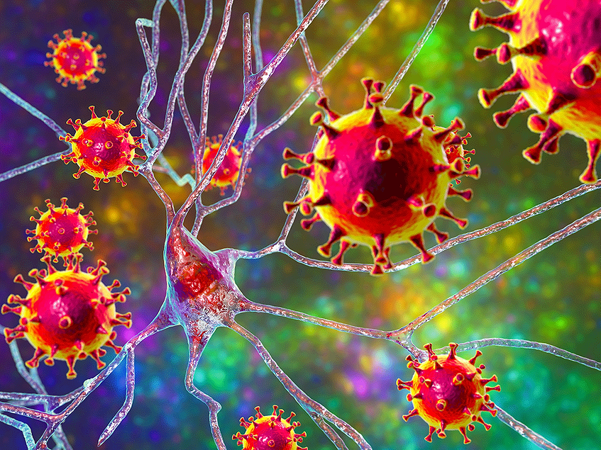Brain infections rare but brain symptoms common with SARS-CoV-2 | 2021 ...