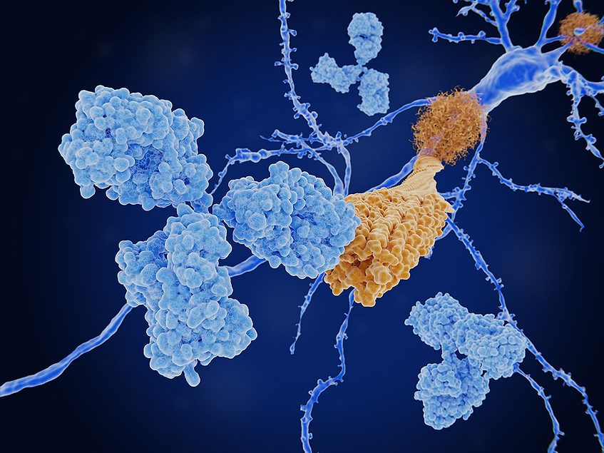 Galimedix targeting misfolded amyloid in retinal disease | BioWorld