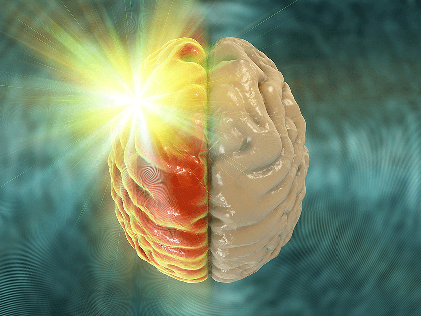 Cerecin closes first tranche of new financing to advance CER-0001 ...