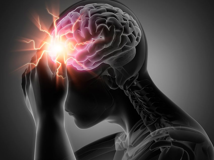 Studies bring insights into link between glymph system, migraine pain ...