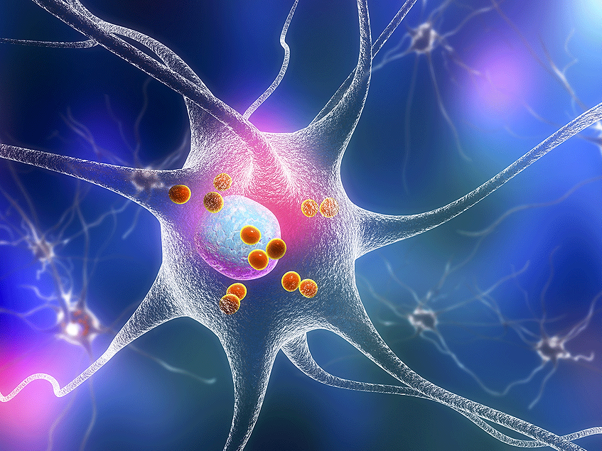 Cerevel undersell? Bombshell Parkinson’s phase III with tavapadon ...