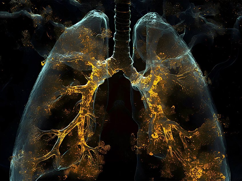 Dual autotaxin inhibitor/PPAR-γ agonist alleviates pulmonary fibrosis ...