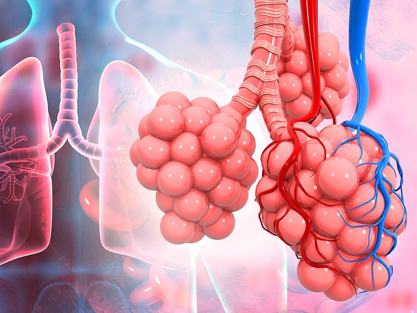 Serum stratifin as new diagnostic biomarker for diffuse alveolar damage ...